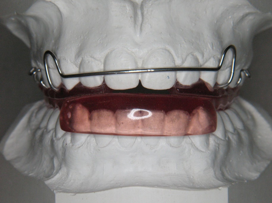 De Activator - Orthodontiepraktijk Wilhelminapark