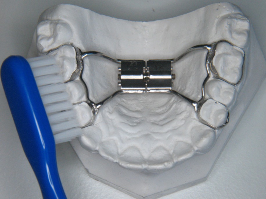 De hyrax - Orthodontiepraktijk Wilhelminapark